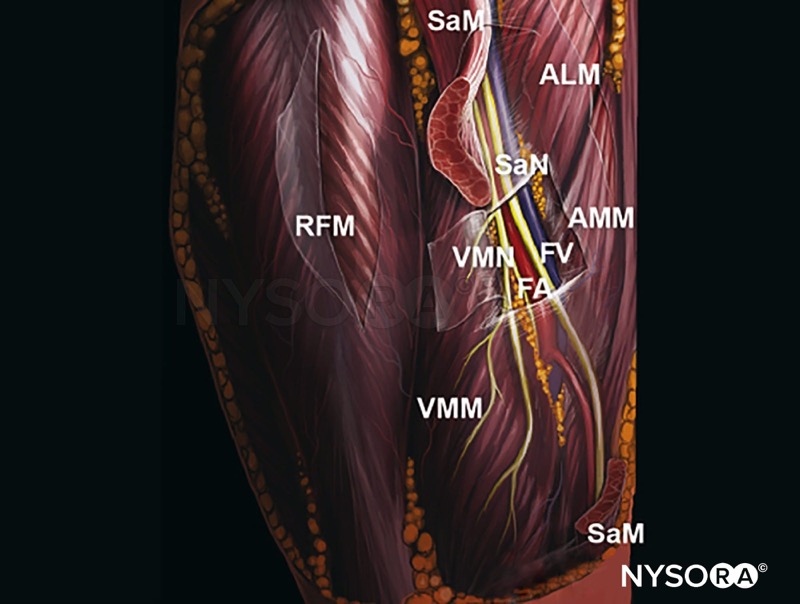 Anatomy of the adductor canal. SaN, saphenous nerve; SaM, sartorius ...