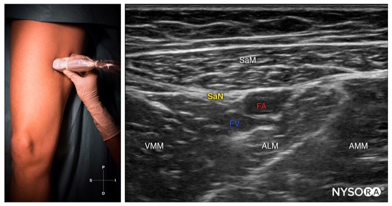 Let's review the block: