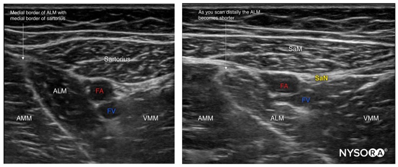 Adductor Muscles Ultrasound